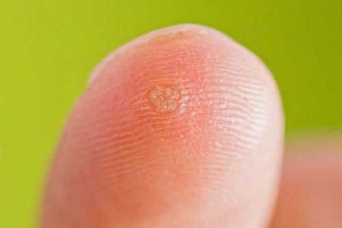 Alta Ridge Foot Specialists | Podiatrist